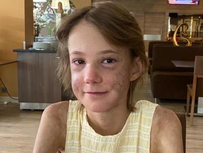 Pola Stupar | Siepomaga.pl