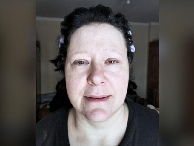 Iwona Dudek Zbiórka Charytatywna Siepomagapl