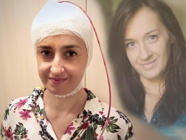 Agnieszka Pacocha - zbiórka charytatywna | Siepomaga.pl